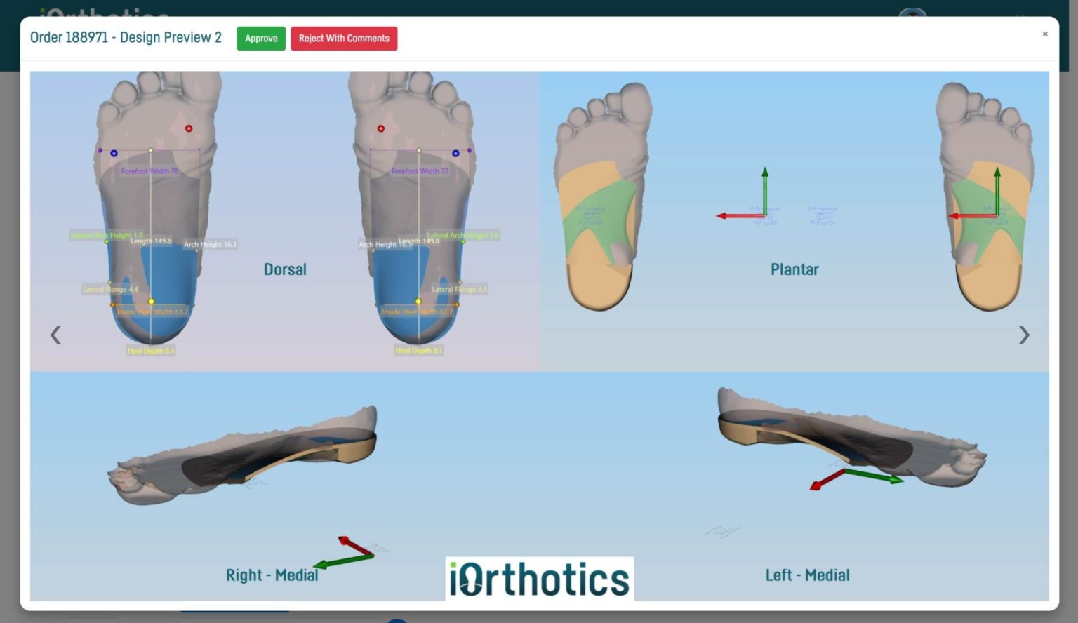 iOrder Platform - iOrthotics